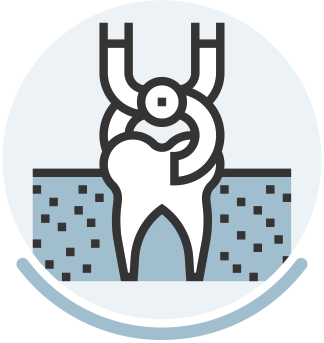 Periodontal Disease - Portland Perio Implant Center