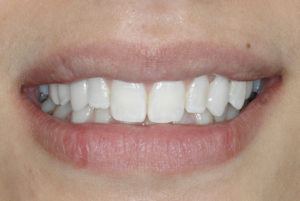 Portland Perio Implant Center - Periodontist, Dental Implants