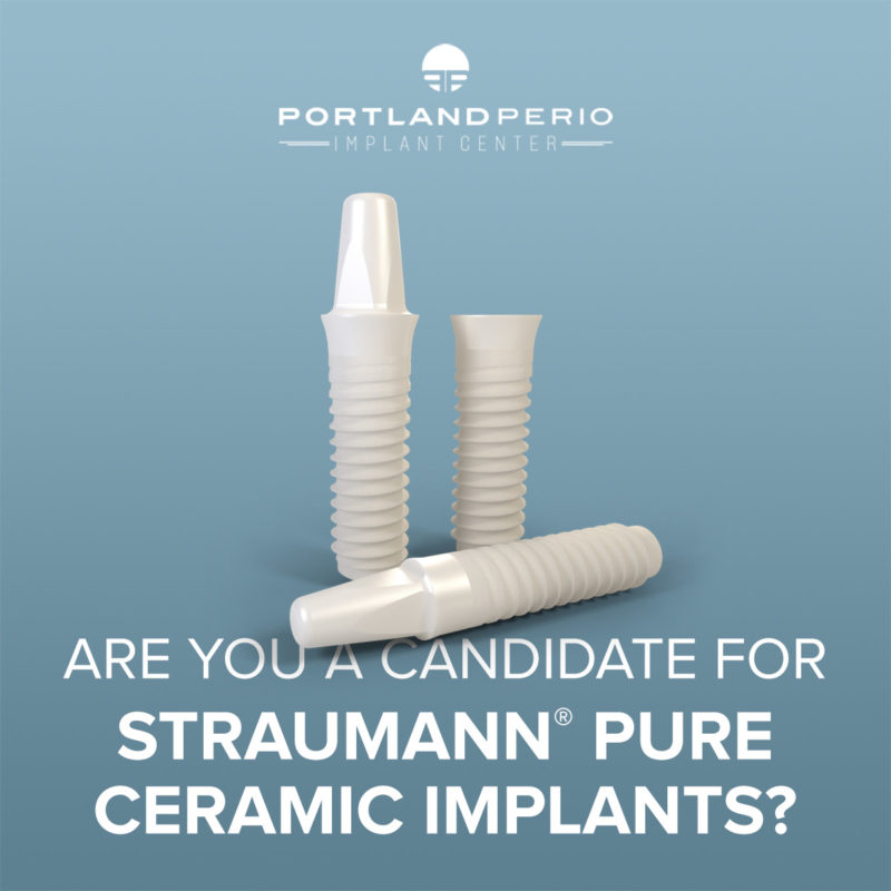 Ceramic vs. Titanium Implants: Which is Right for You?