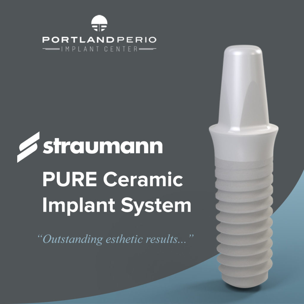 Discover the Benefits of Straumann® PURE Ceramic Implants