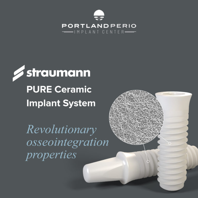 Discover the Benefits of Straumann® PURE Ceramic Implants