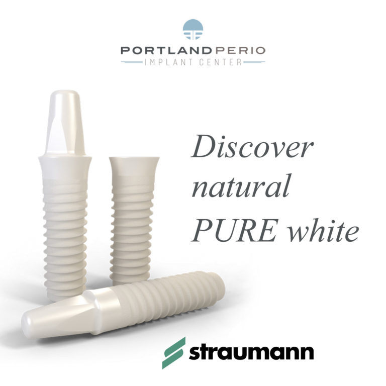 Discover the Benefits of Straumann® PURE Ceramic Implants